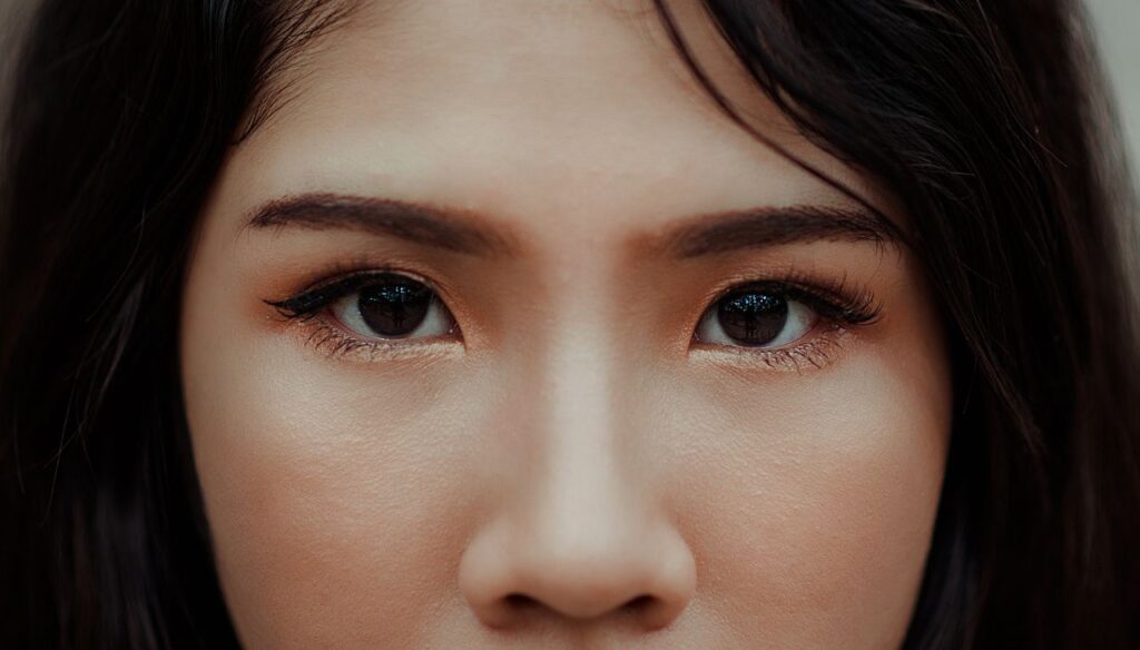 HIKO Nose Thread Lift: The Ultimate Guide Before Considering Nose ...